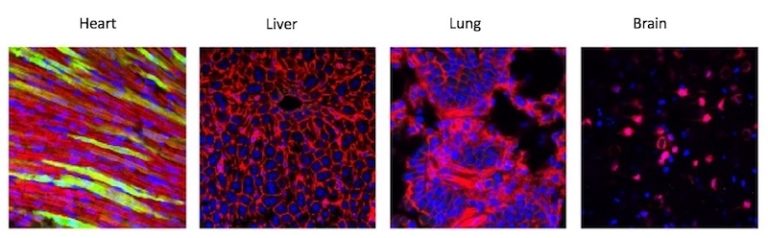 Tissue models inform a possible gene therapy treatment for CPVT ...