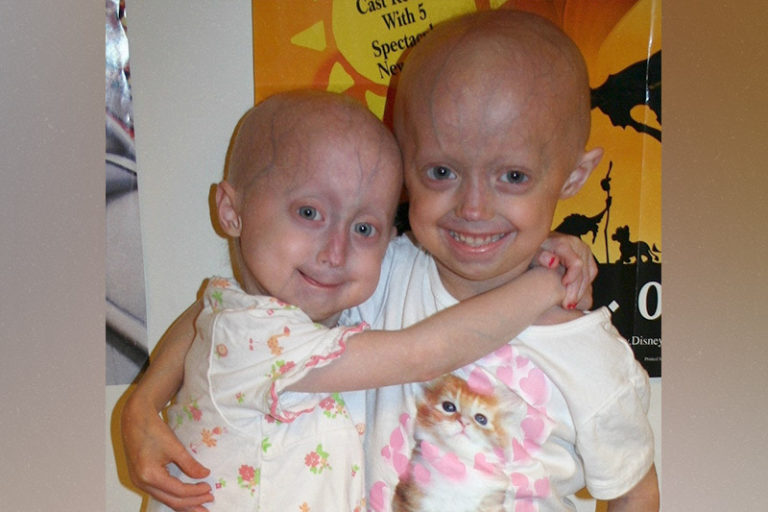It’s personal: How the Boston Children’s progeria research community ...