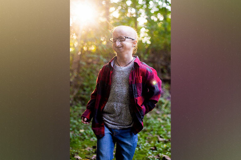 It’s personal: How the Boston Children’s progeria research community ...