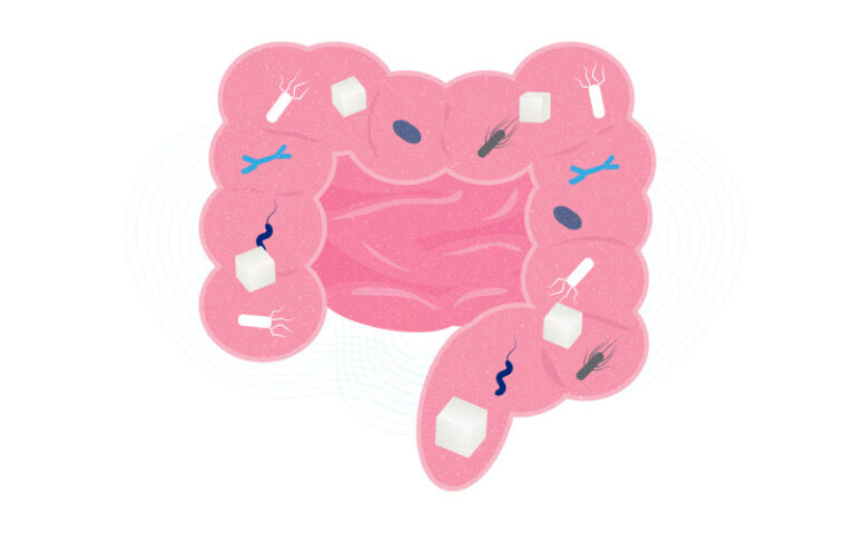 Shaping the intestinal microbiome - Boston Children's Answers