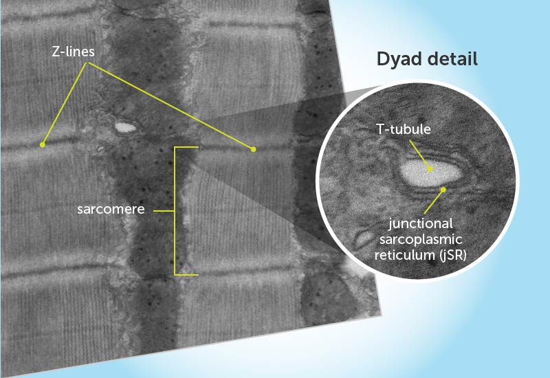 Dyads and CMYA5: Going to the heart of heart muscle - Boston Children's ...