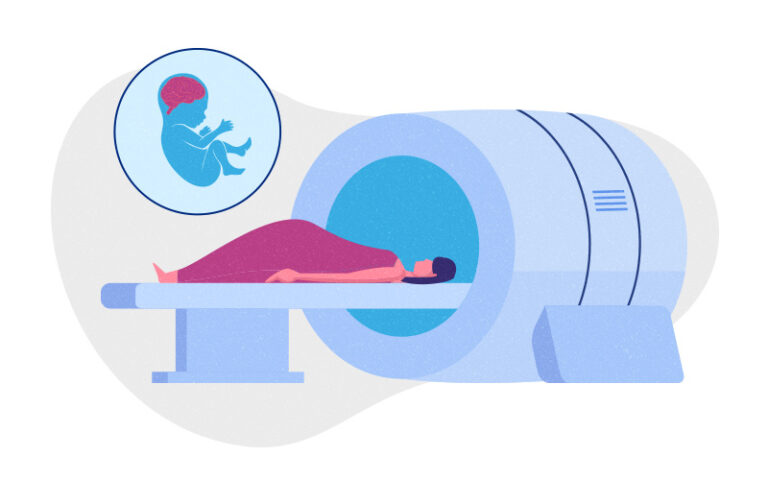 Predicting neurodevelopment in congenital heart disease with fetal ...
