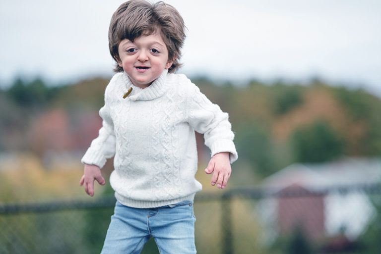 Superando as dificuldades da síndrome de Apert: a história do João