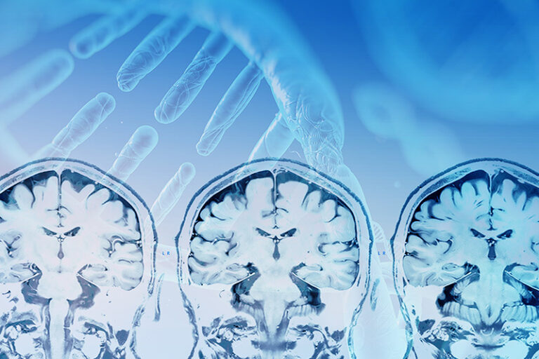 The Brain Gene Registry: When diagnosis is just the first step - Boston ...