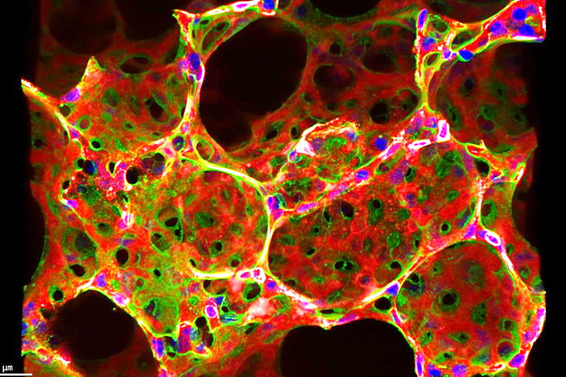 Pericytes tied to pulmonary disease - Boston Children's Answers